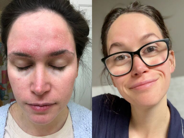 Crunchi Makeup & Skincare Review: Is It Worth the Hype? - cassieschmidt.com